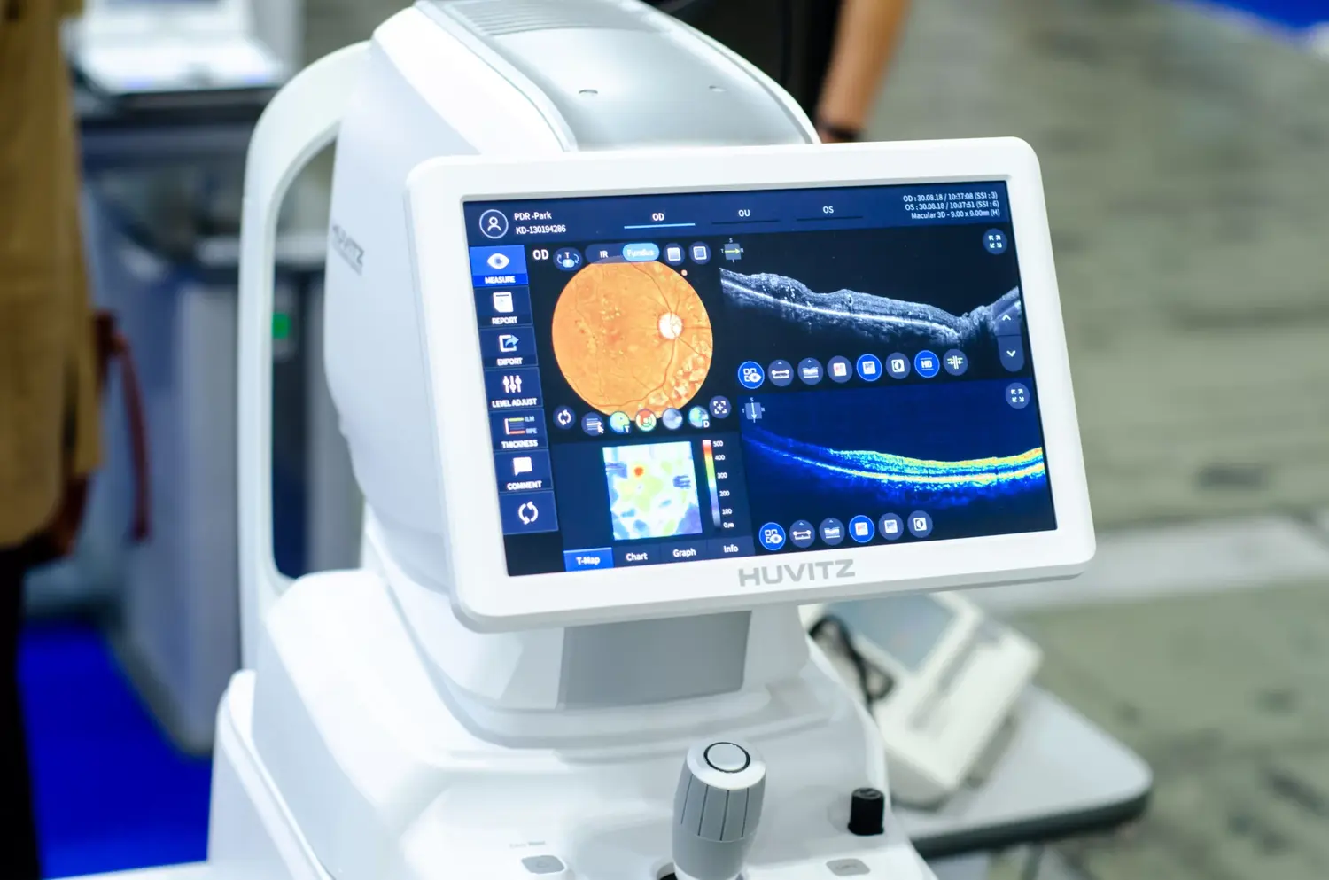 Optical Coherence Tomography in Non-Destructive Testing - shanghai revamp